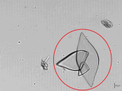 Types of Crystals Found In Human Urine and Their Clinical Significance ...