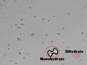 Types of Crystals Found In Human Urine and Their Clinical Significance ...