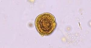 Types of Crystals Found In Human Urine and Their Clinical Significance ...