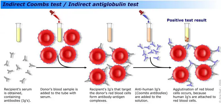 Coombs Test : Types, Principle, Procedure and Interpretation ...