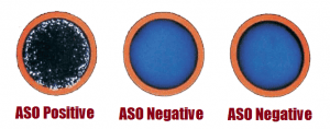 Anti-Streptolysin O (ASO) Test : Principle, Procedure, Interpretation ...
