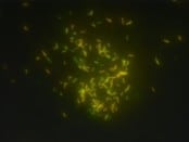 Auramine-Rhodamine Staining for AFB : Principle, Procedure, Reporting ...