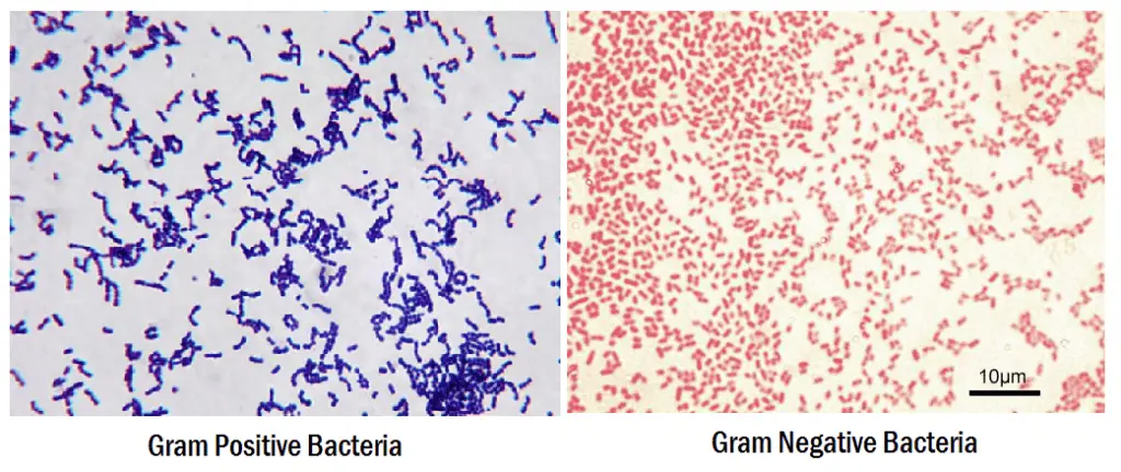 Gram Staining : Principle, Procedure, Interpretation and Animation ...