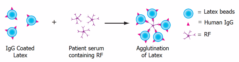Rheumatoid Factor (RF) Test : Principle, Procedure, Interpretation and ...