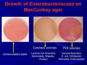 MacConkey Agar – Plate, Purpose, Ingredients and Principle ...