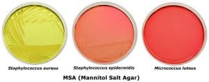 Mannitol Salt Agar - Plate, Test, Composition, Preparation, Uses ...