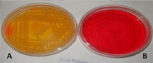 Mannitol Salt Agar - Plate, Test, Composition, Preparation, Uses ...