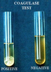 Coagulase Test - Laboratoryinfo.com
