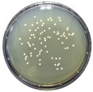 Tryptic Soy Agar Composition and (Vs Nutrient agar) - Laboratoryinfo.com