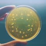 What is the Ames Test - Procedure, Uses, Principle and Interpretation ...