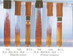Motility Tests for Bacteria – Principles, Procedures and Results ...