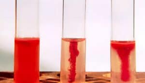 Motility Tests for Bacteria – Principles, Procedures and Results ...