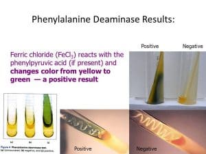 Phenylalanine Deaminase Test – Procedure, Principle and Uses ...