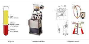 Buffy Coat – Laboratoryinfo.com