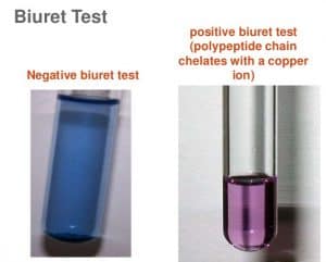 What does Biuret test for? Its Principle, Mechanism and Uses ...