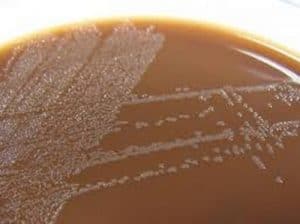 Chocolate Agar media - Preparation and Uses - Laboratoryinfo.com