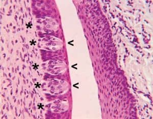 Microvilli – Definition, Diagram (Vs Villi and Cilia) and Function ...