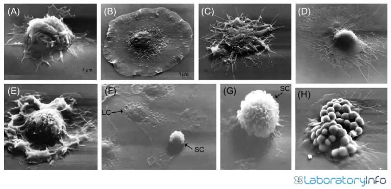 Circulatory System of the Earthworm – Laboratoryinfo.com