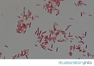 Gram-negative Bacteria: Characteristics, List, Cell wall composition ...